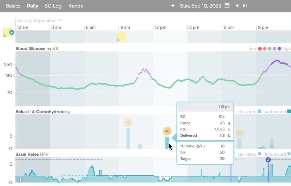 Viewing Diabetes Data - Daily View – Tidepool