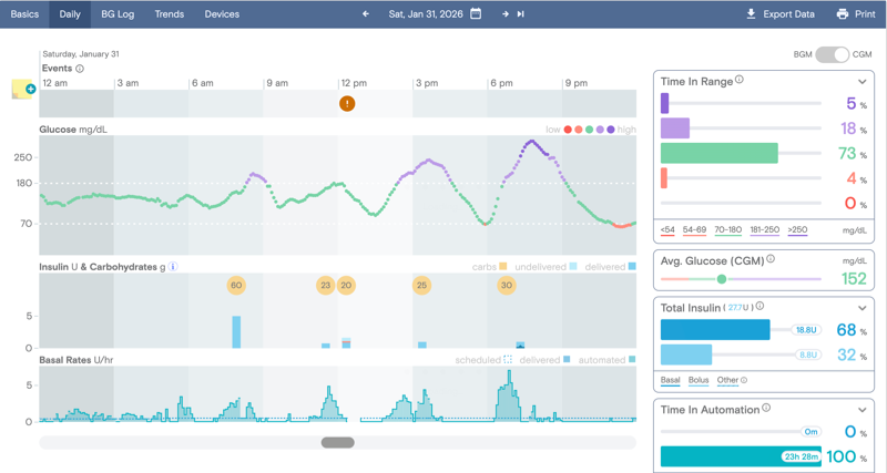 Viewing data from your twiist Automated Insulin Delivery (AID) system ...